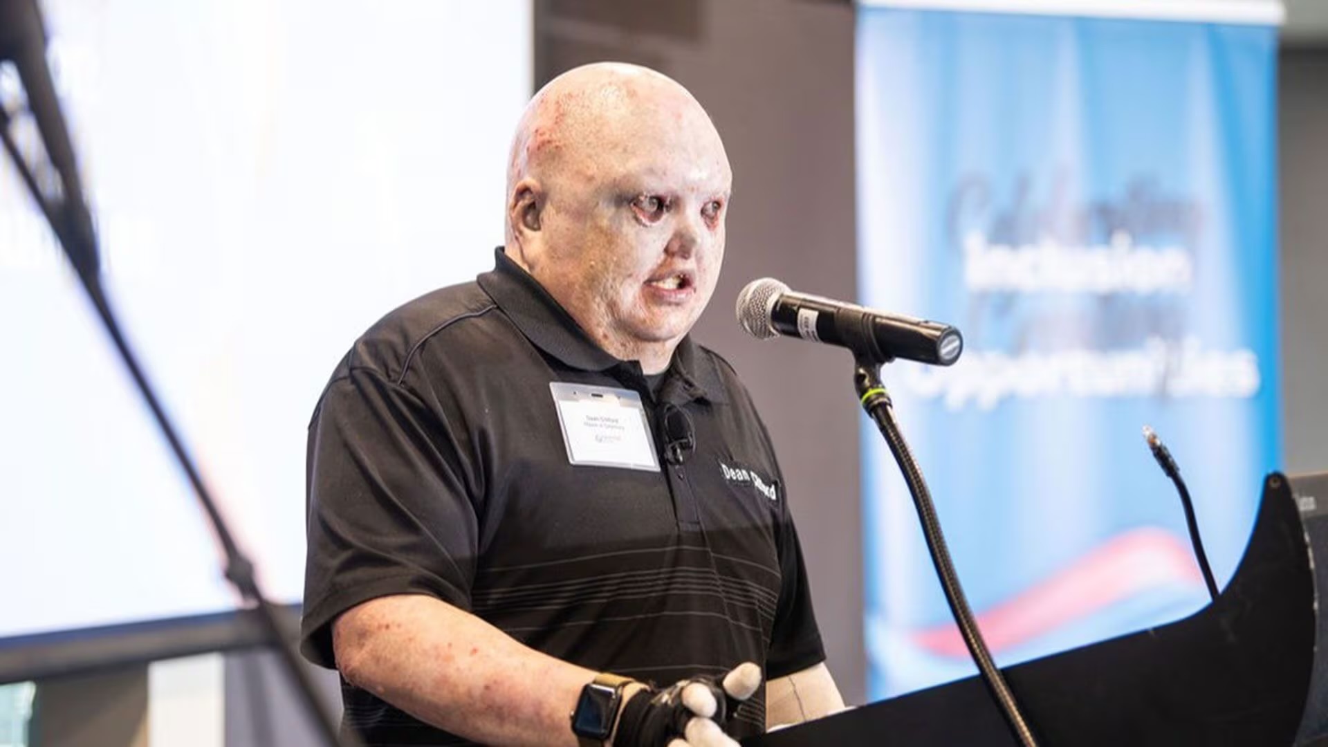 Dean Clifford: Un ejemplo de resiliencia y valentía contra la ...